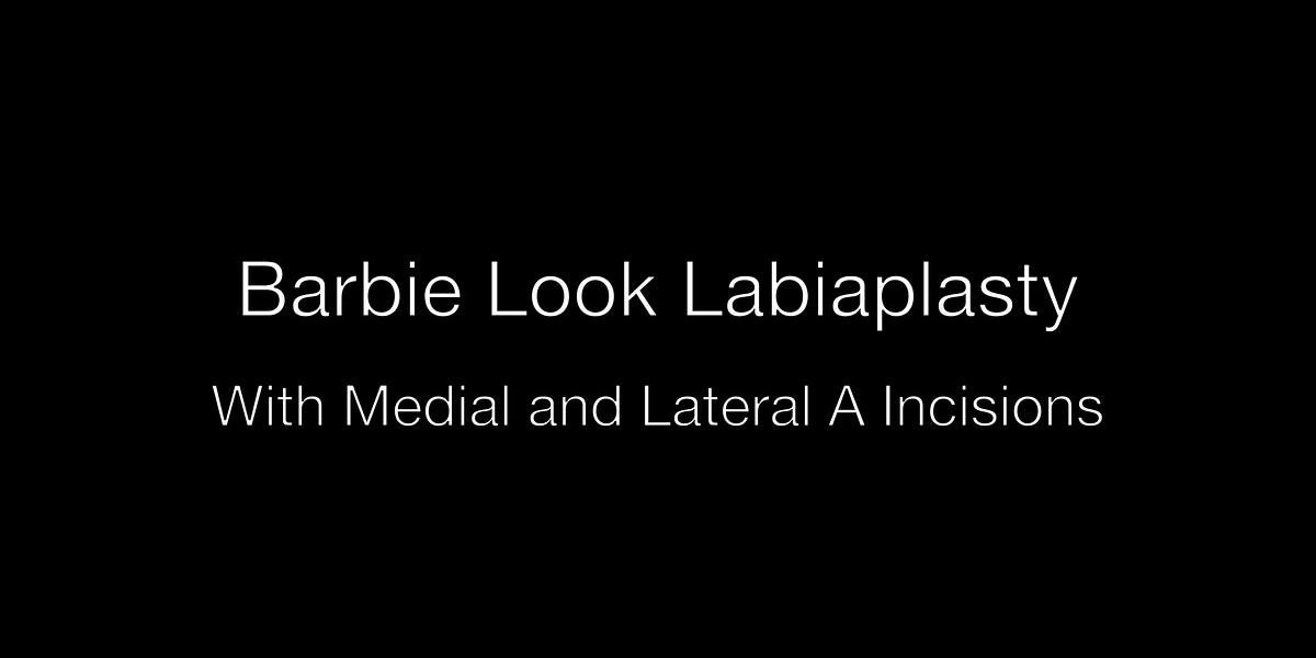 LNS15: Barbie Look Labiaplasty with Medial and Lateral A Incisions