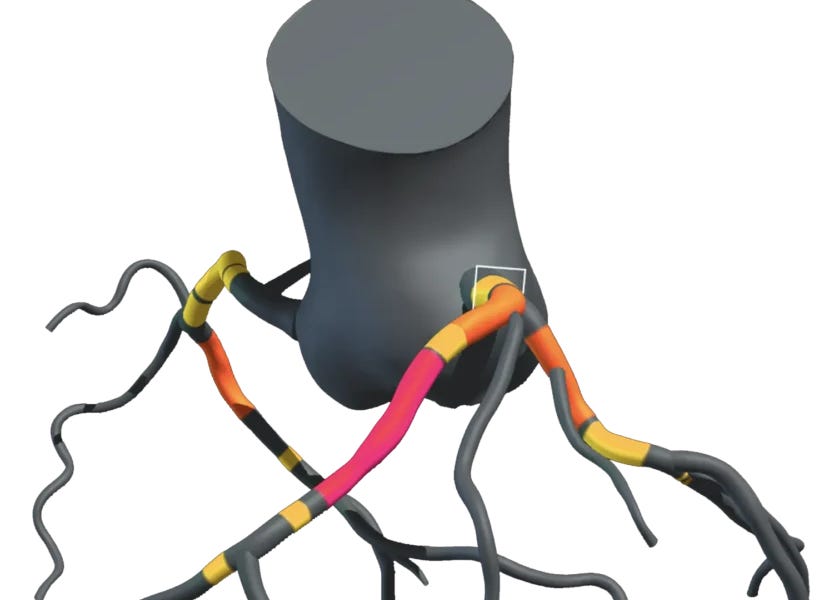 Artrya’s AI Heart Scan Breakthrough: FDA Clears Path for US Expansion