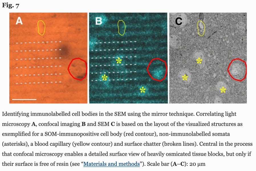 Correlating immunohistochemistry with serial block-face electron ...