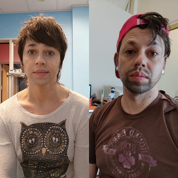 Biohacking to Change My Gender - by Jo Zayner, PhD