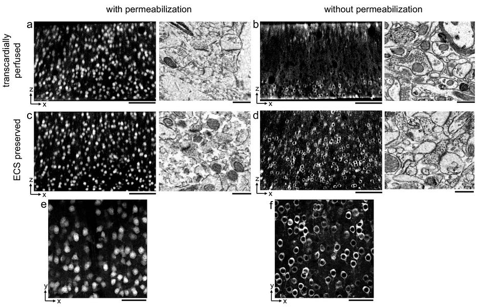 Extracellular space preservation with immersion fixation of brain sections