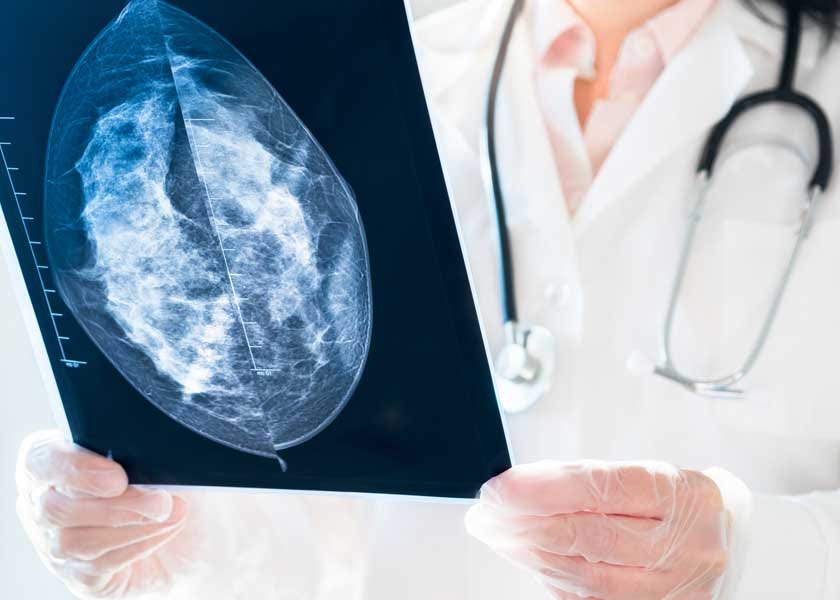 50% of Women Had a False-Positive Mammogram After 10 Years
