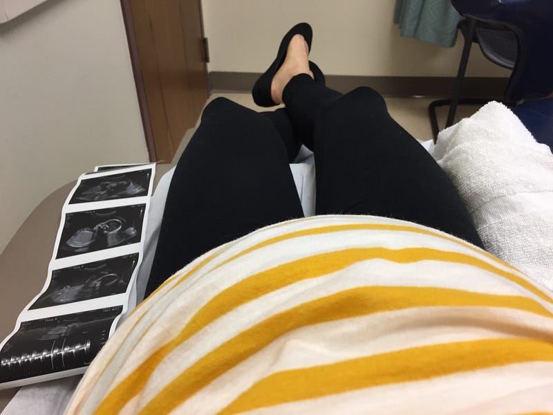 What to Expect - by Joy Lere, Psy.D. - Finding Joy