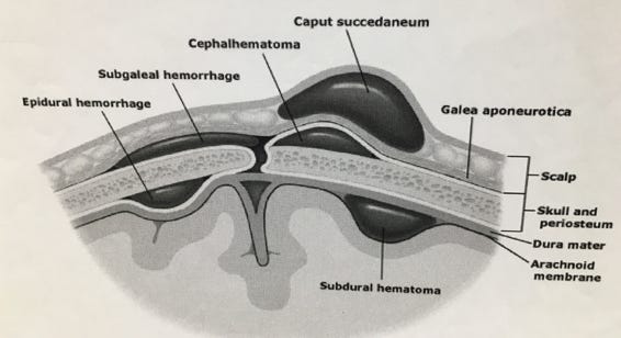 Pediatric Pearls: Infant's Head - Bumps, Lumps and Soft Spots