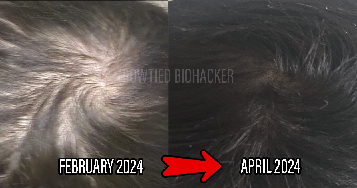 Best Health & Wellness Newsletters on Substack