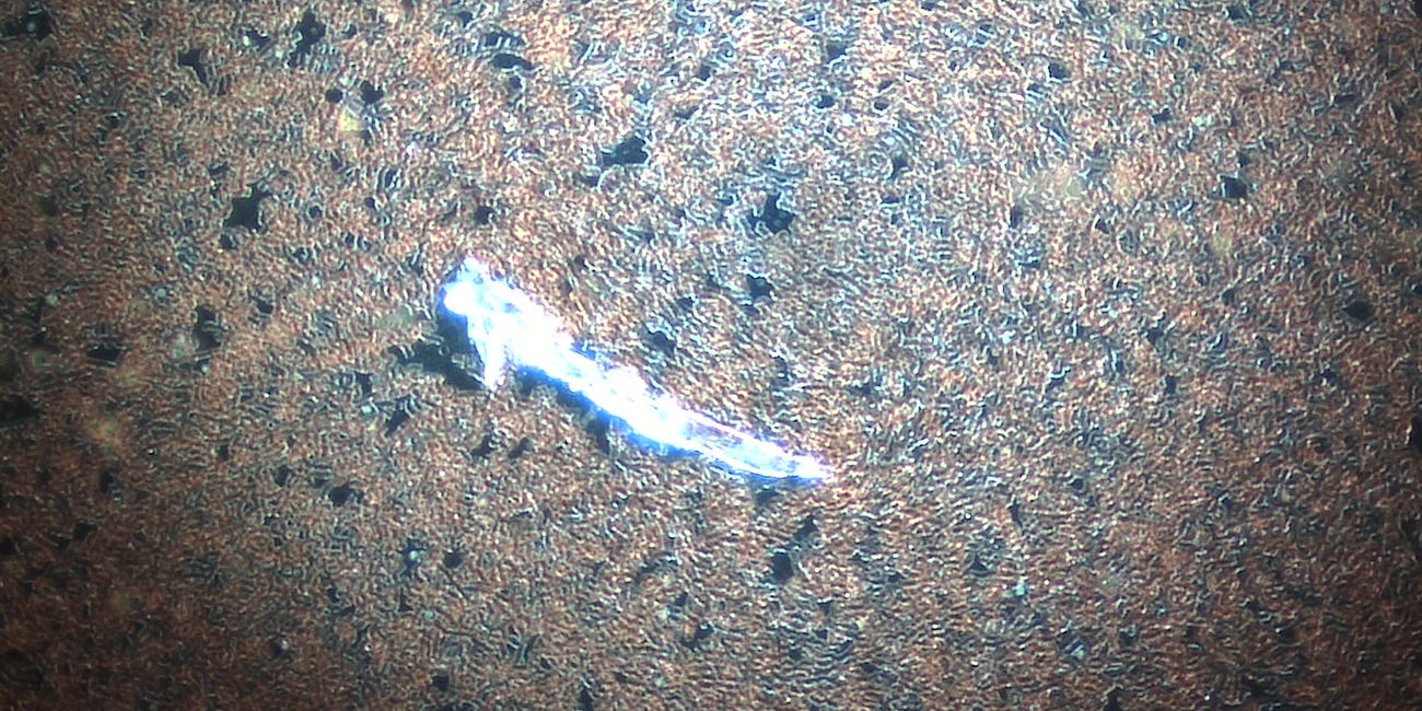 Blood Conductivity and Electrical Impedance Spectroscopy - A New Model ...