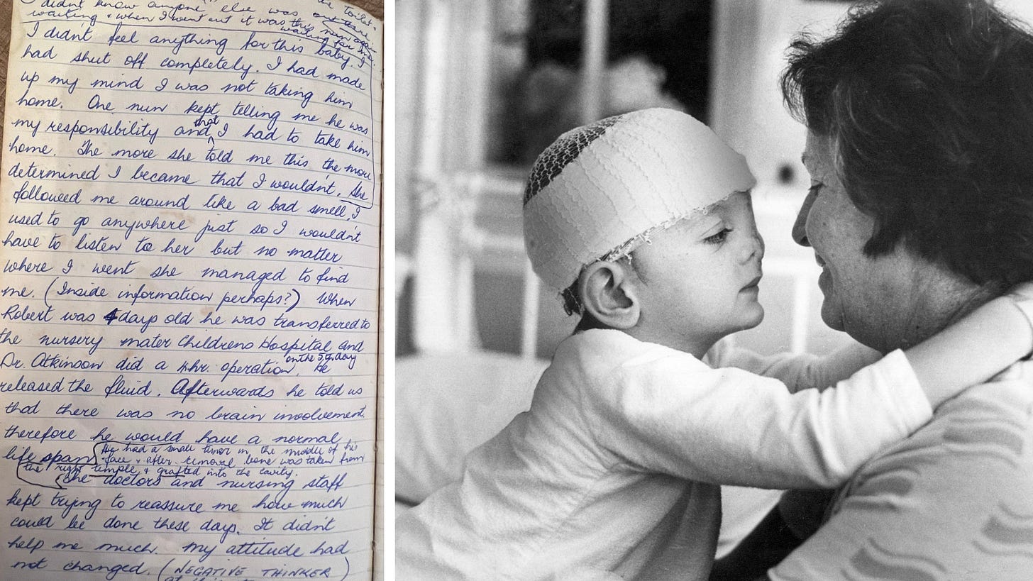 The Profile Original: Meet Robert Hoge, the ‘Ugly’ Human Living a ...