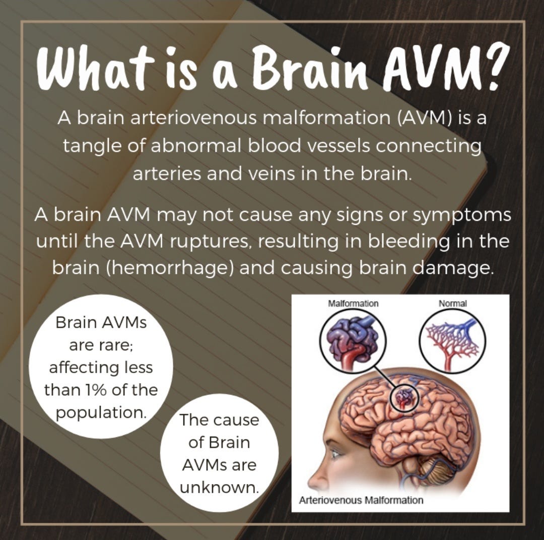 Arteriovenous Malformation - by SM