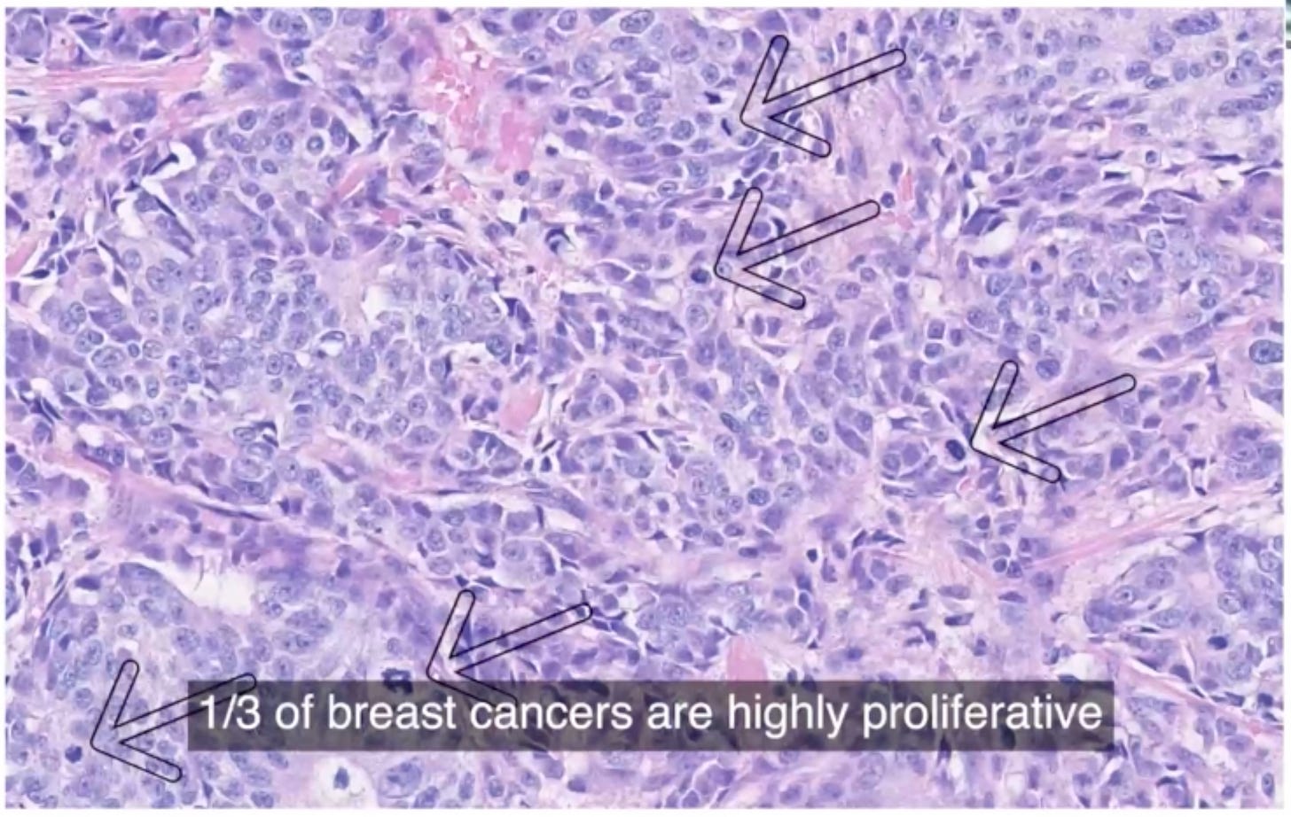 "Two Weeks Ago I Saw a Tumor That Was 16 Centimeters in Size"