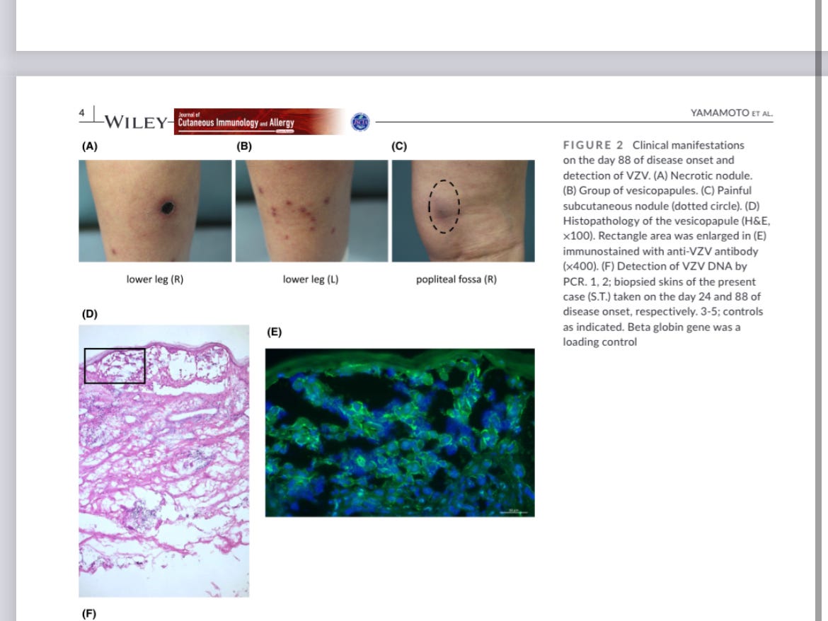 mRNA shots are the gift that keeps on giving