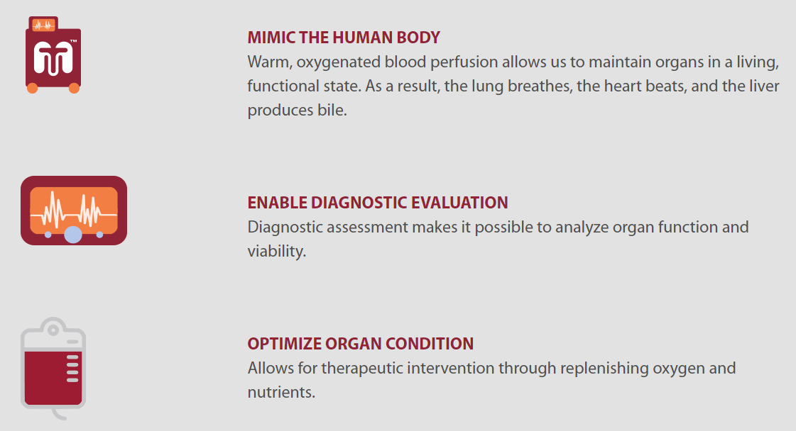 $TMDX - TransMedics - by Jonah Lupton