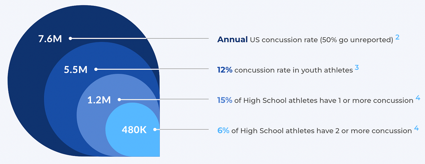 Concussion Technology - Profluence