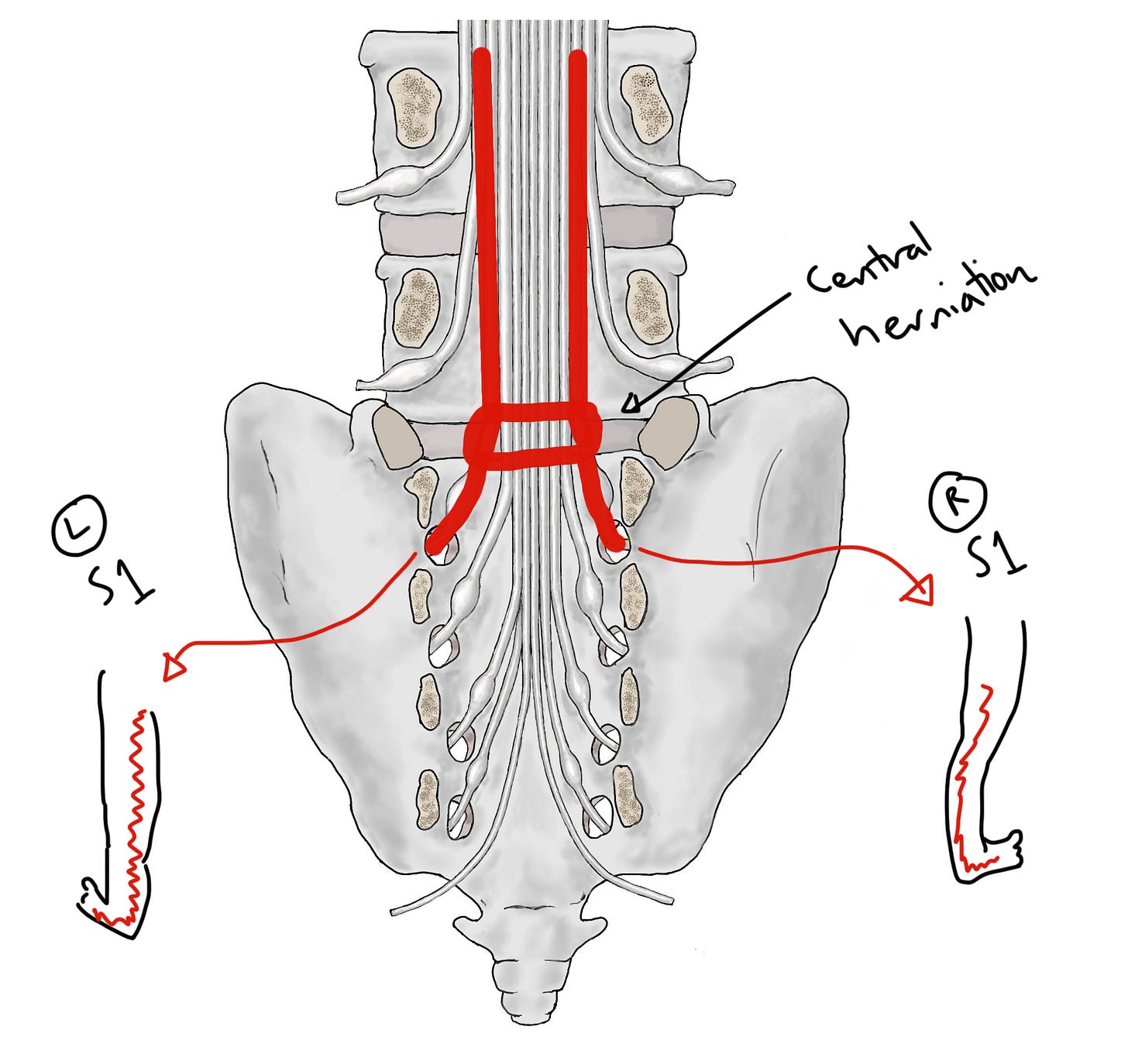 So, uh, what is CES anyway? – Tom Jesson Books