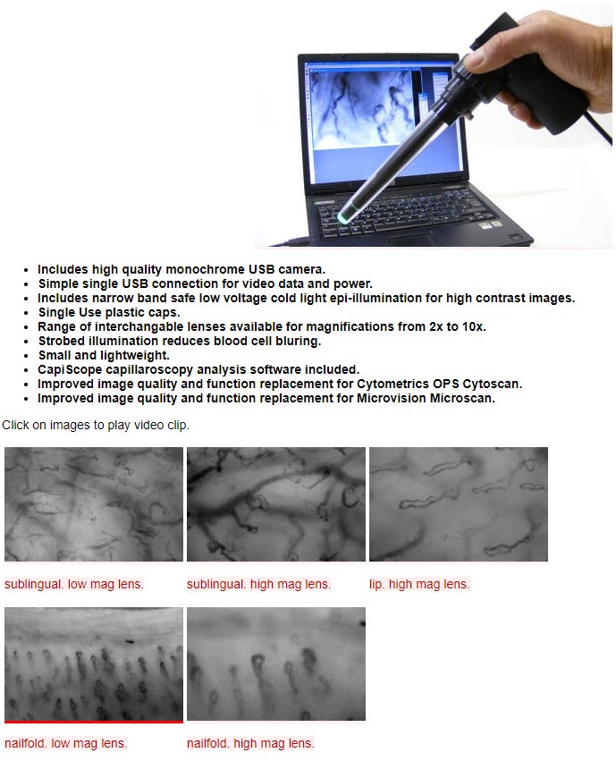 Persistent capillary rarefication in long COVID syndrome