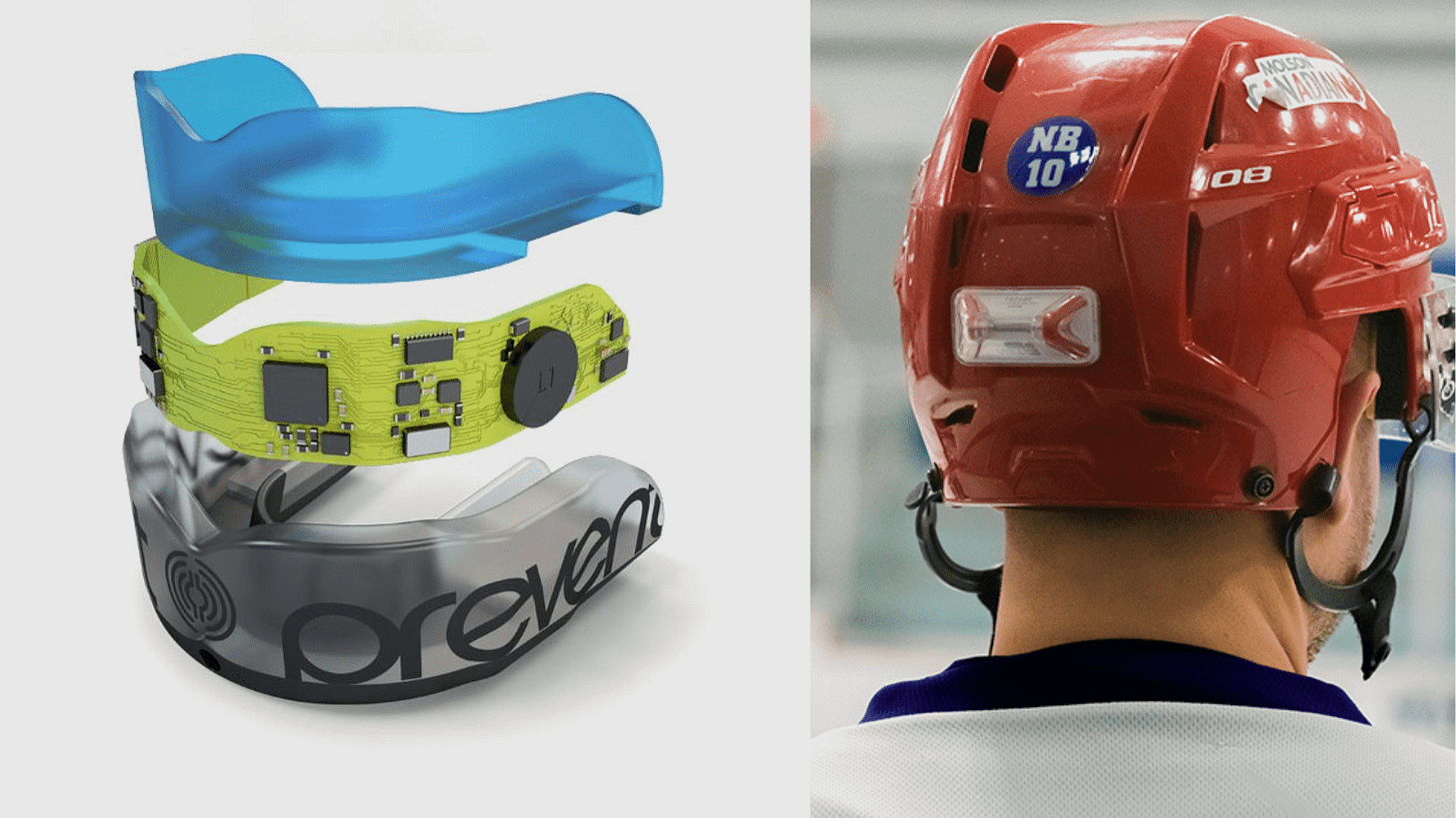 Concussion Technology - Profluence