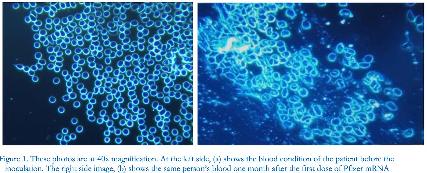 What is Causing the Blood Clots from "Died Suddenly?"