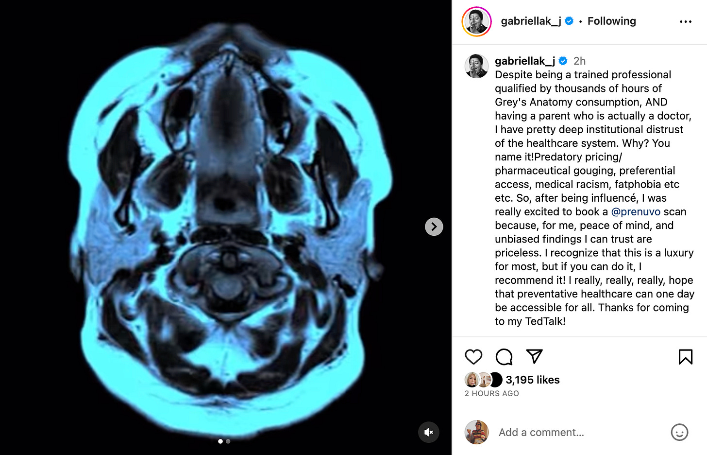 Ron DeSantis's teeth grinding - by Emily Kirkpatrick