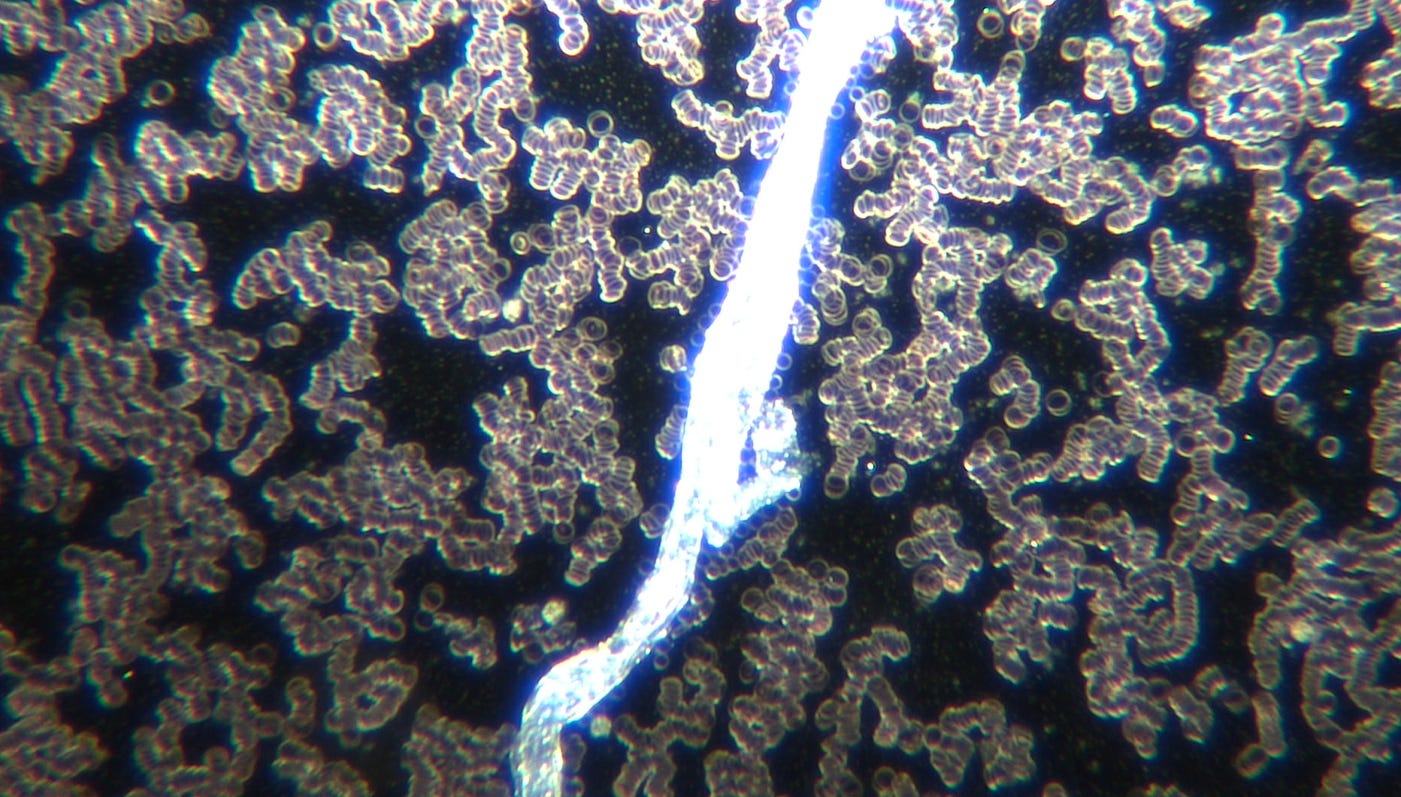 Hydrogel Coagulates Blood and Causes Blood Clots