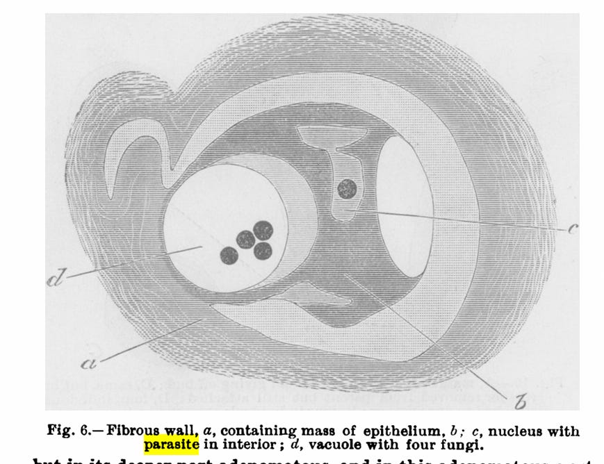 Cancer and Parasites - Tom Renz’s Newsletter