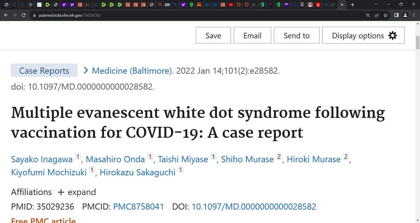 Multiple evanescent white dot syndrome (MEWDS) is an acute, usually un ...