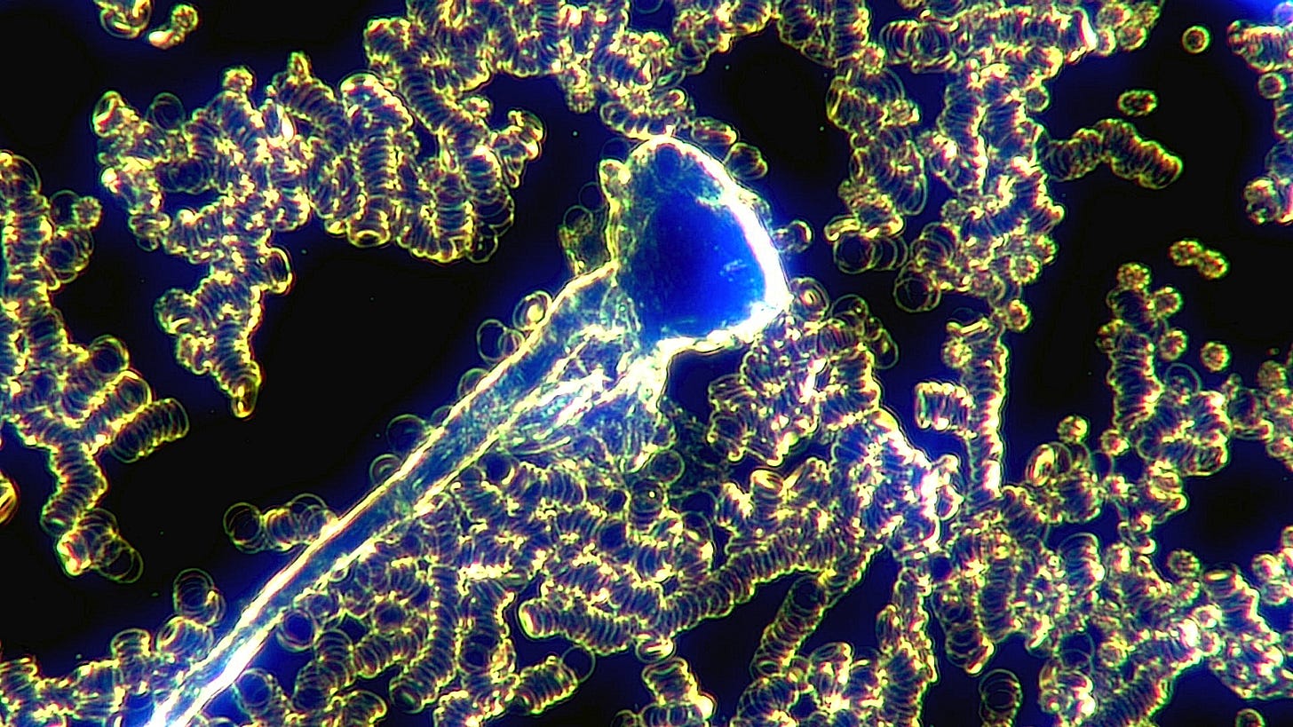 A long boring post. - by matt. j.a.o.b - matt’s microscopy