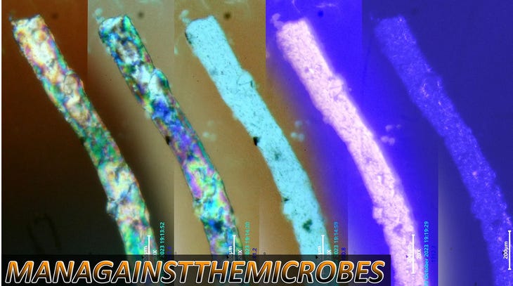 Fluorescent Filaments Coming Out Of C19 Vaccinated Individuals Skin ...