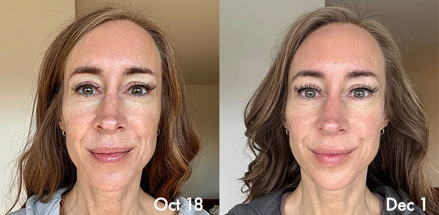 I have a multi-step skincare routine now