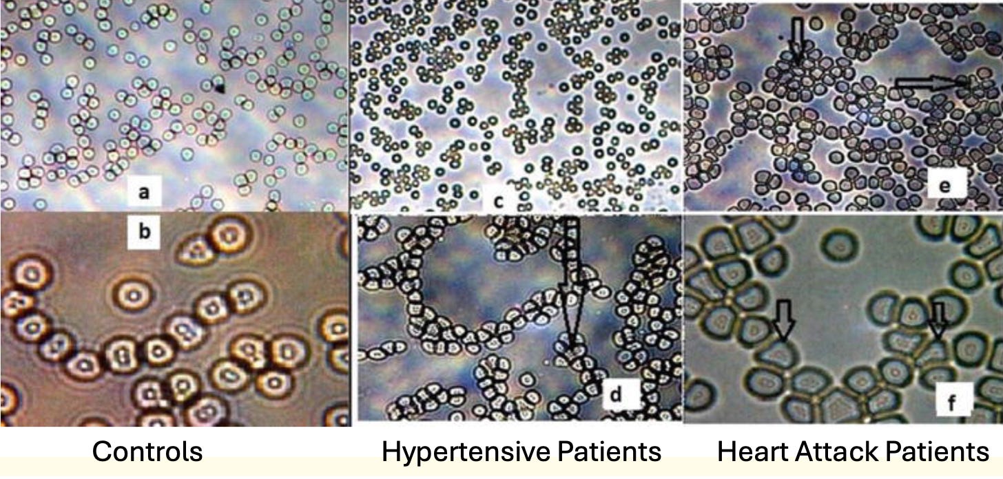 The Great Blood Pressure Scam - by A Midwestern Doctor
