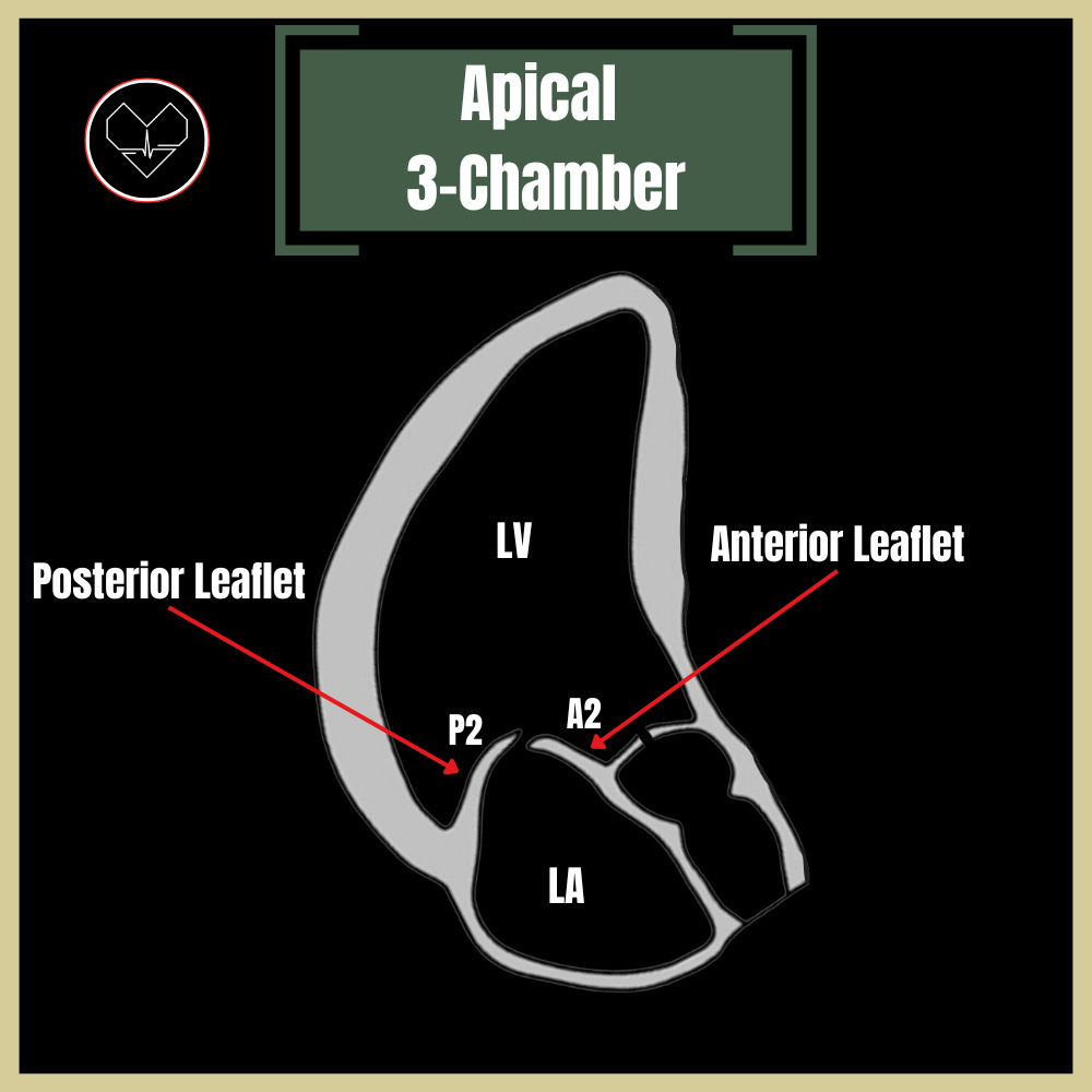 Mitral Valve: Beyond the Basics - by Alex C.