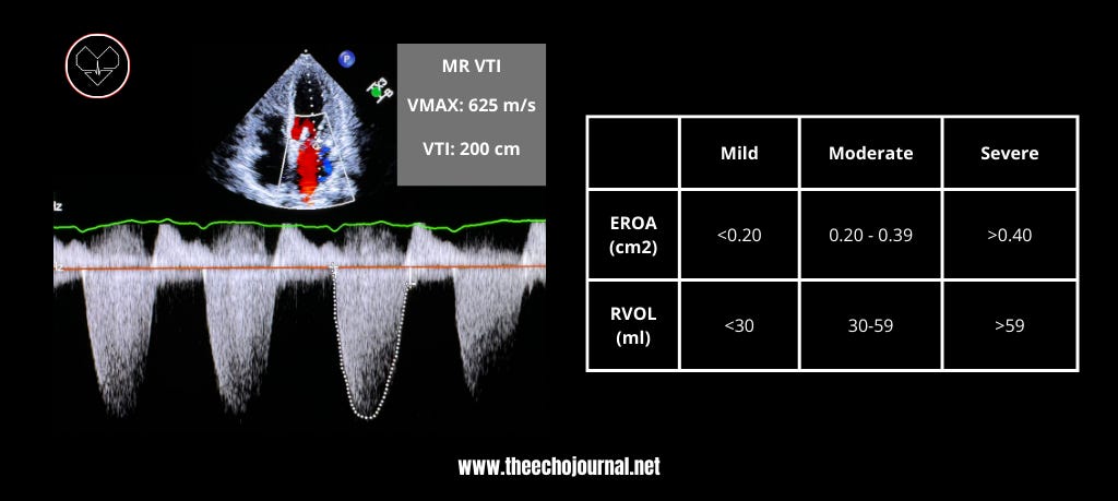 PISA: Tips, Tricks & More - by Aram K. - The Echo Journal