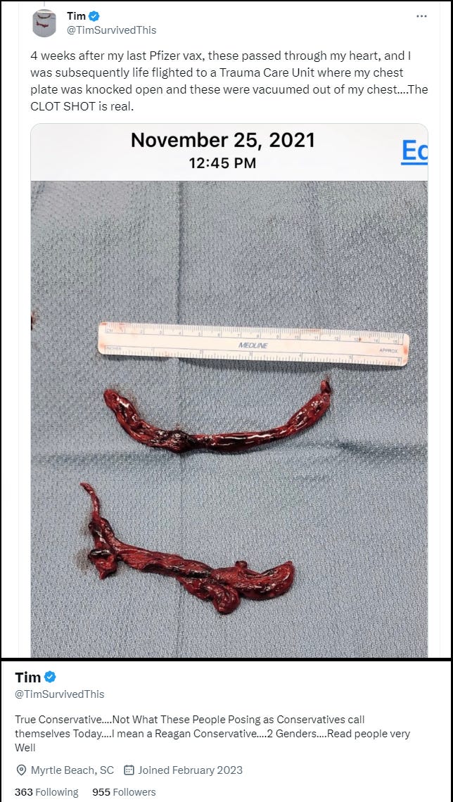 Pfizer COVID-19 mRNA Vaccine Blood Clots in the Heart Up to 40cm Long ...