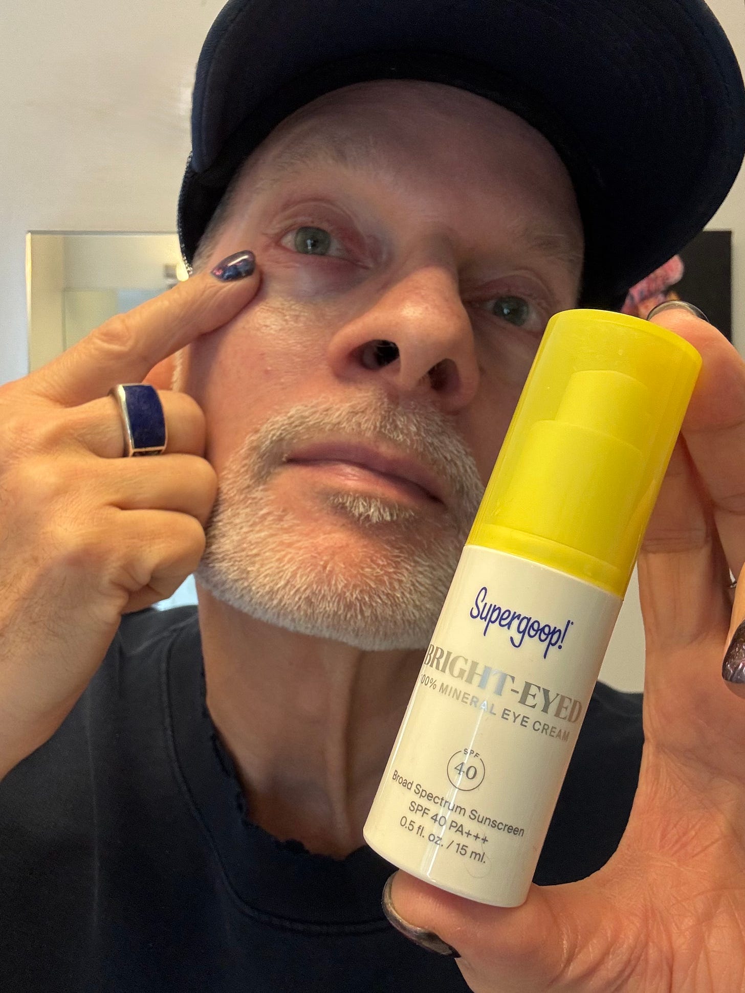 The Truth About Dark Circles and Why They're So Hard to Treat