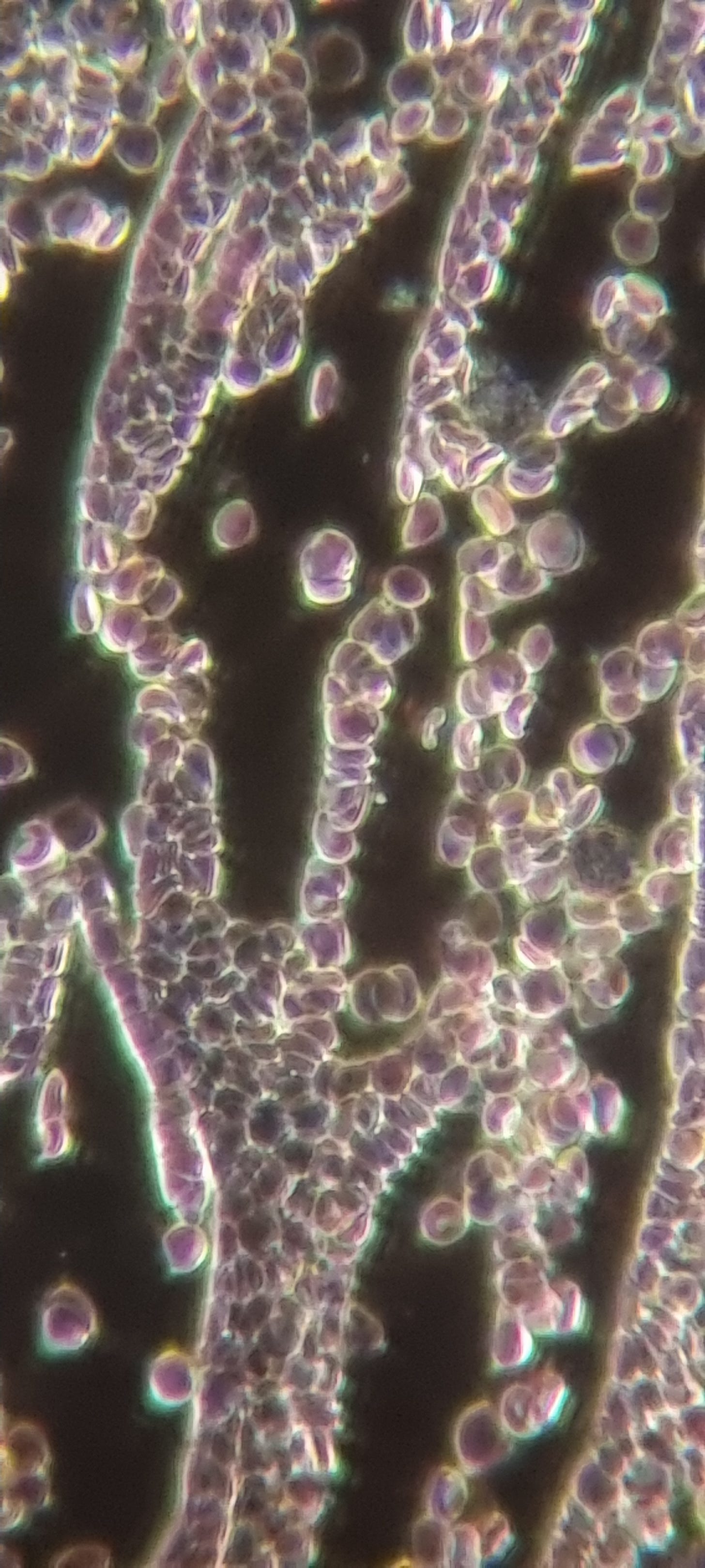 Exploding gel bubbles and WBC's, Glaucoma meds, bot breath and sundry.