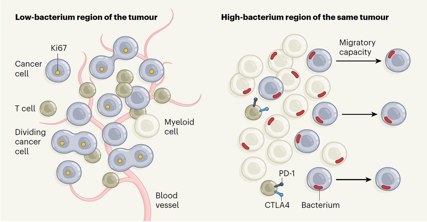 The fascinating and evolving story of bacteria and cancer