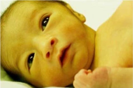 Pediatric Pearls: Infant's Skin Part 1 - Color Variations