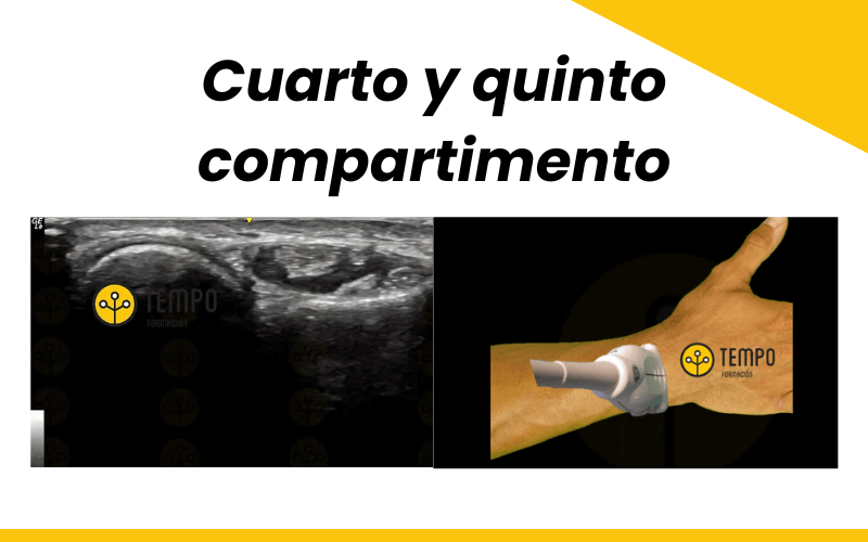 Compartimentos extensores de la muñeca - by Tempo Formación
