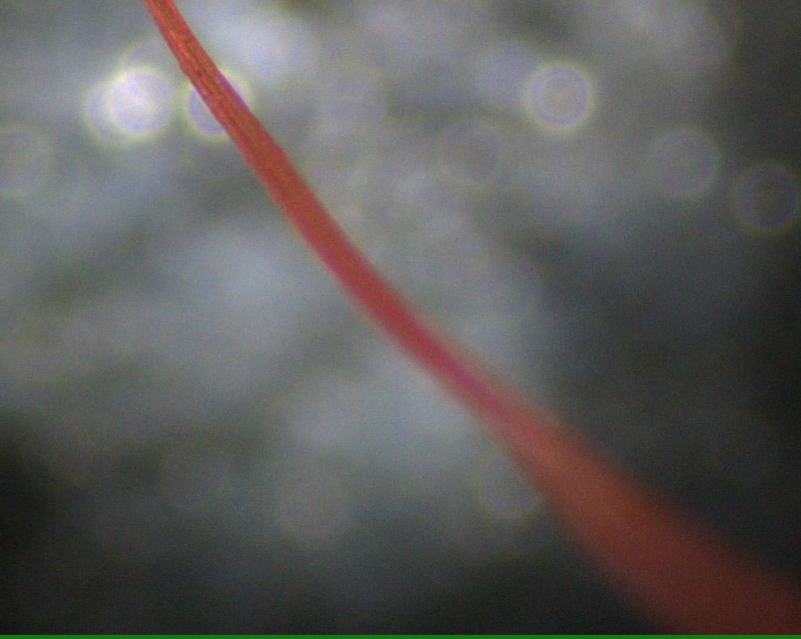 Fluorescent Filaments Coming Out Of C19 Vaccinated Individuals Skin ...