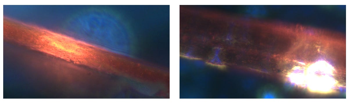 Fluorescent Filaments Coming Out Of C19 Vaccinated Individuals Skin ...
