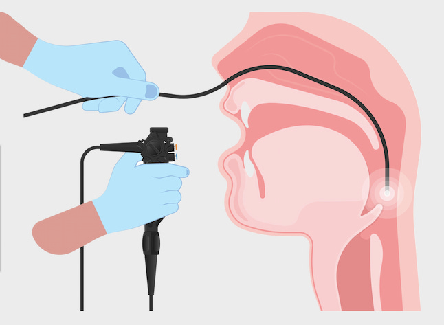 Pediatric Pearls: Infant's Airway - Understanding Laryngomalacia