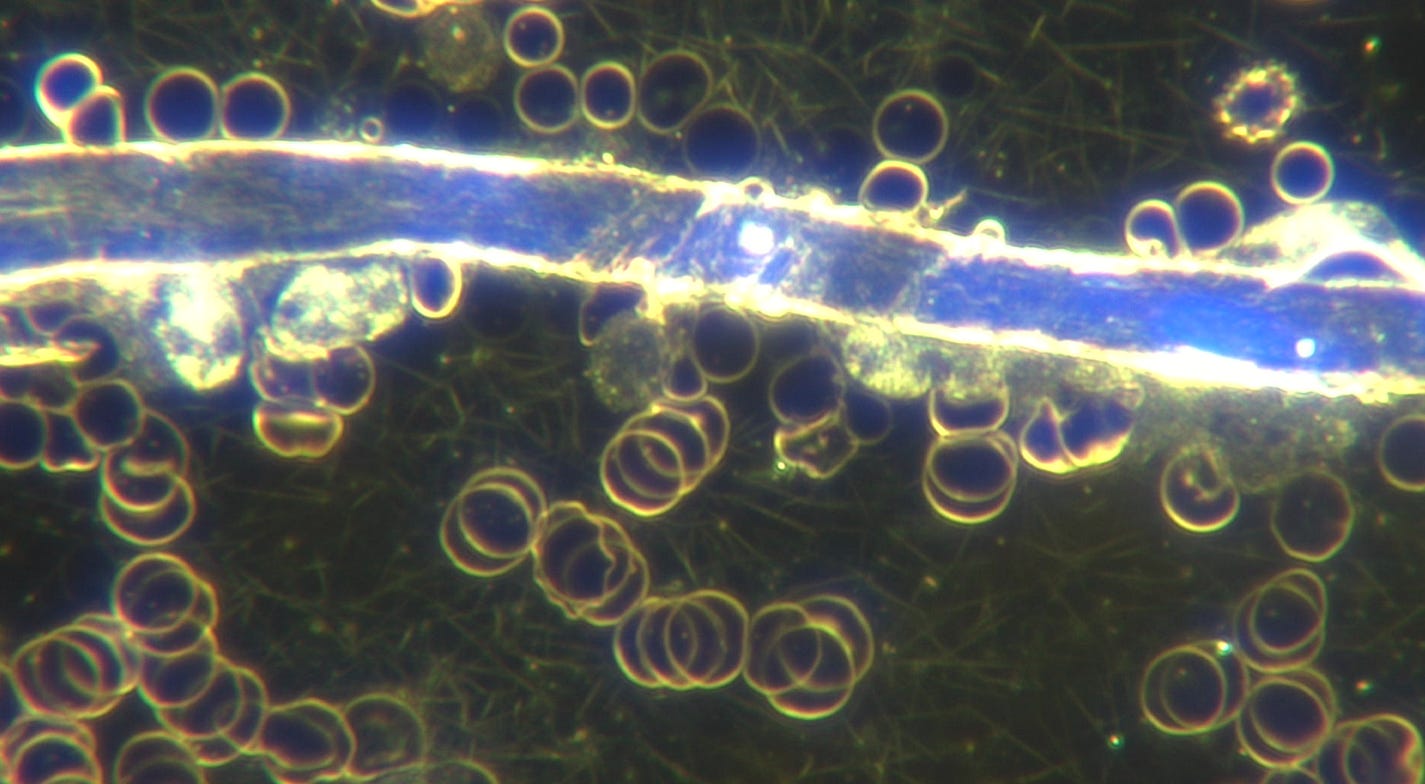 Hydrogel Coagulates Blood and Causes Blood Clots