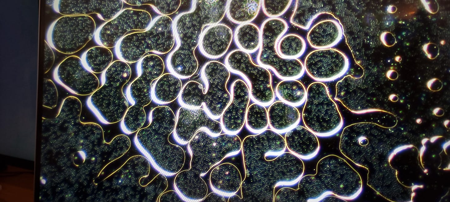 Exploding gel bubbles and WBC's, Glaucoma meds, bot breath and sundry.