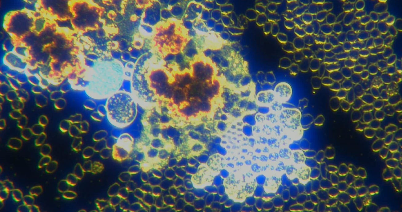 Lipid Vesicle-Based Molecular Robots | Confirms What We Are Seeing In ...