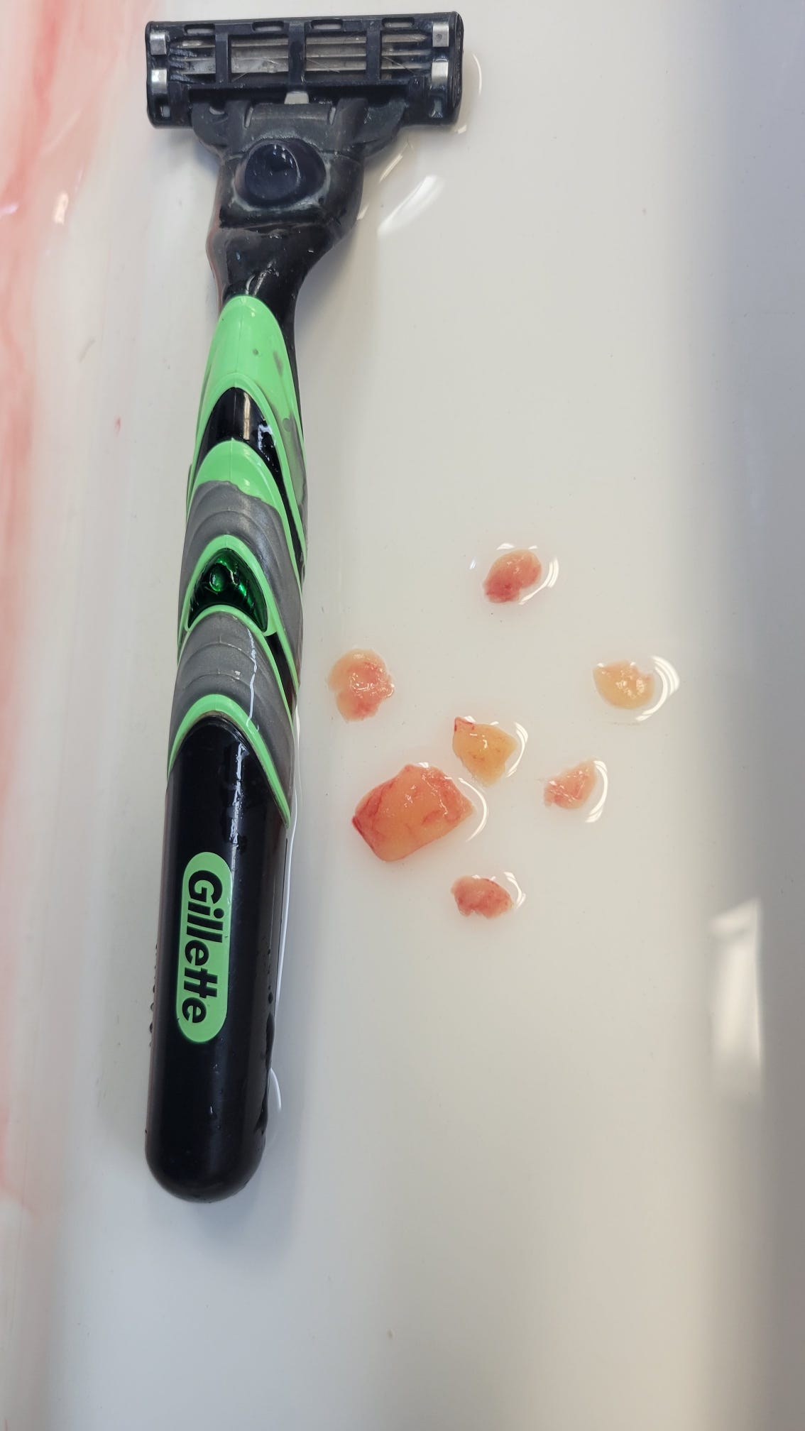 EMBALMER BLOOD CLOTS - by Laura Kasner - Clotastrophe