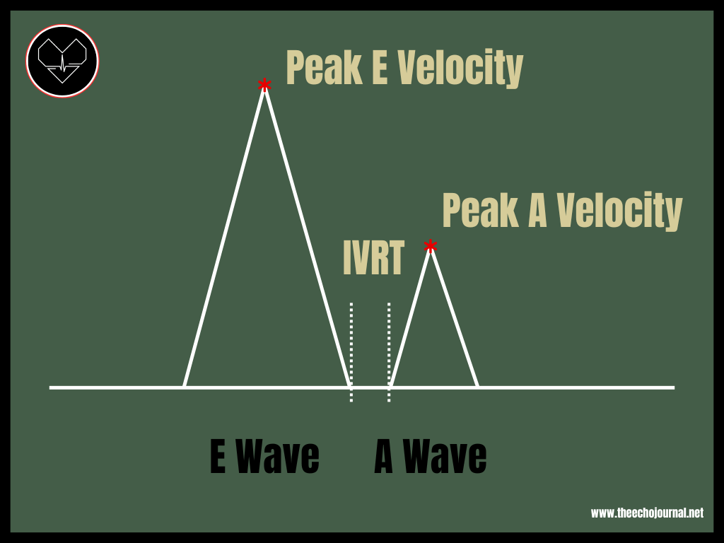 Diastology: The Meaning Behind The Waves - by Aram K.