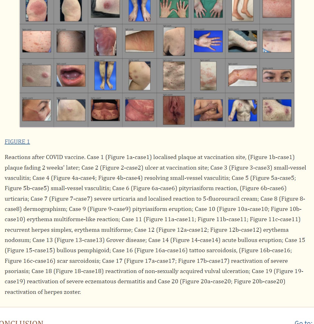 Cutaneous reactions to C-19 injections - by OUTRAGED HUMAN