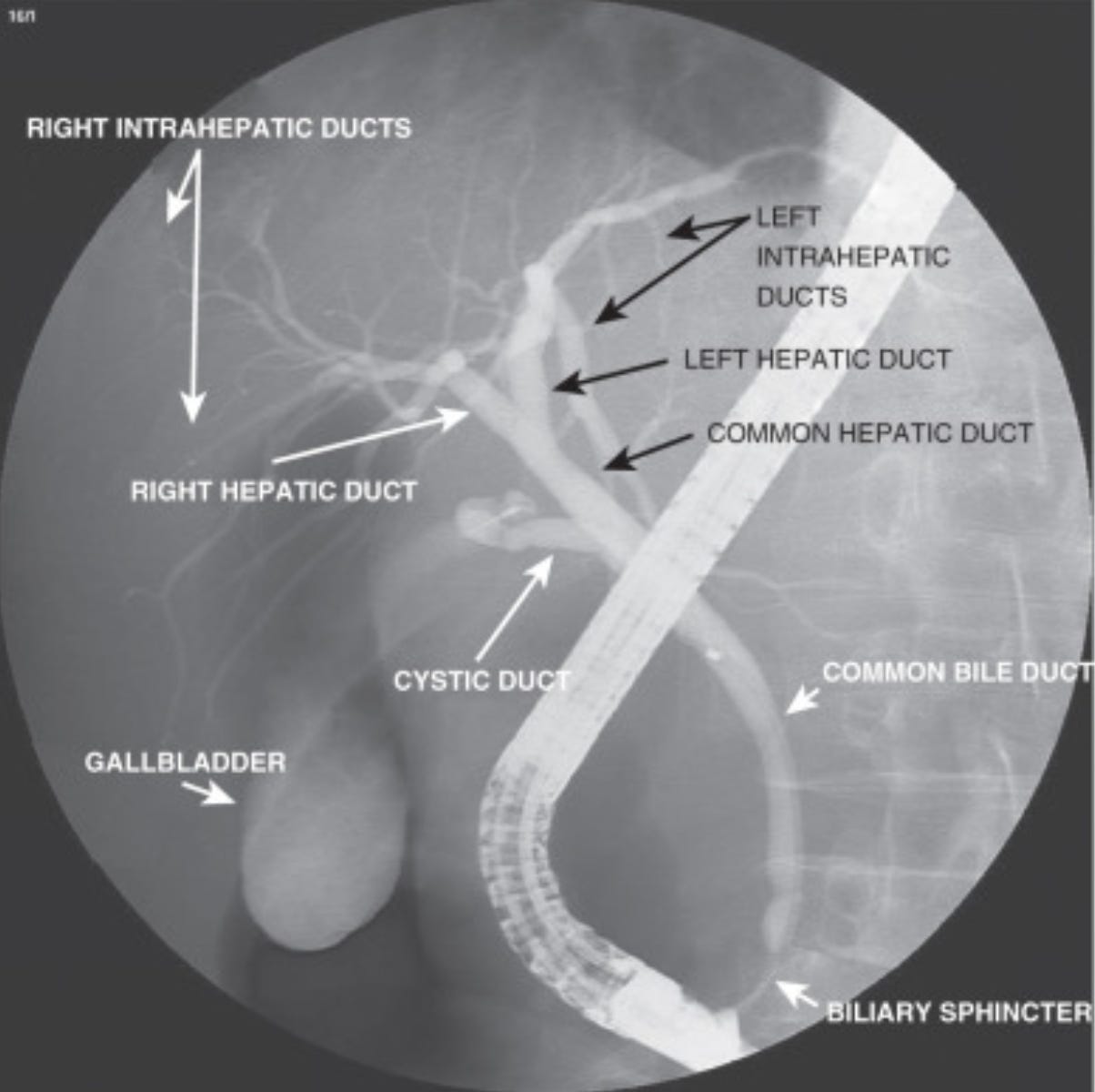 ERCP Explained: Why It's Done and What to Expect - Dr Arif Hussenbux