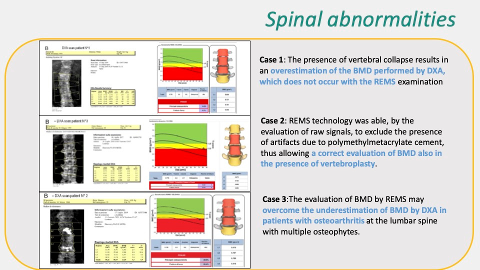 R.E.M.S. - by A Midwest Doctor