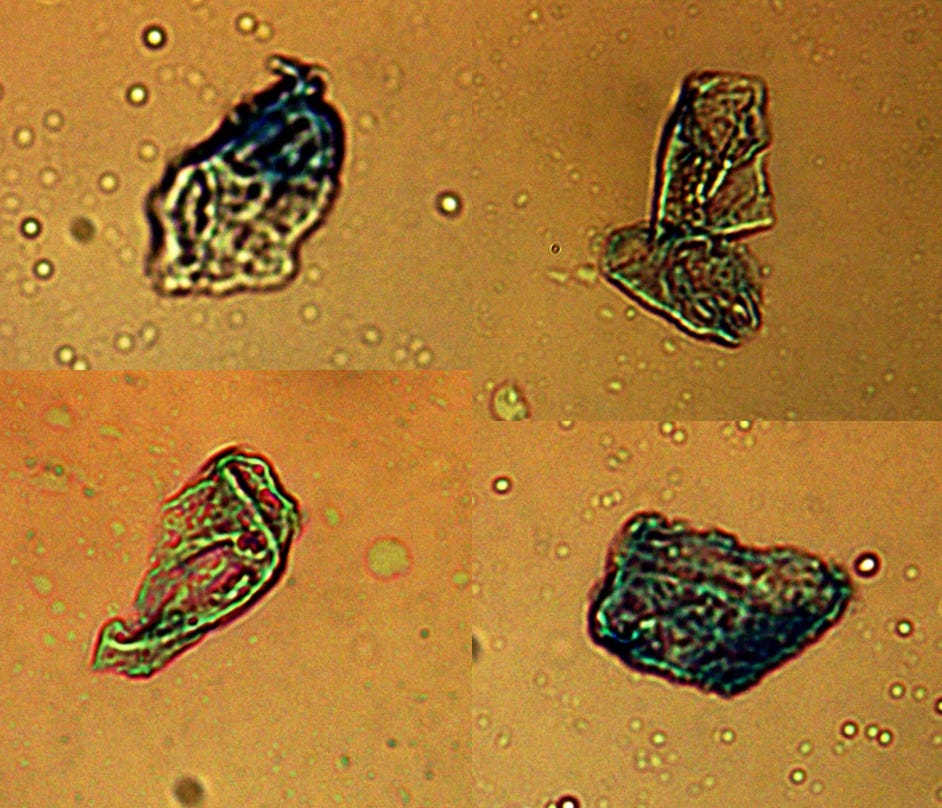 Discussion Of Microscopy of Dental Anesthetics Compared To CDB Cultures ...