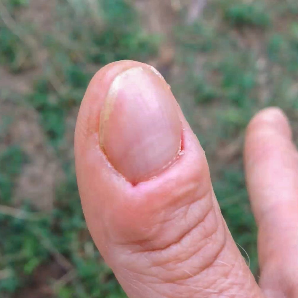 Egy apró molekula, hihetetlen erővel! - KariKór