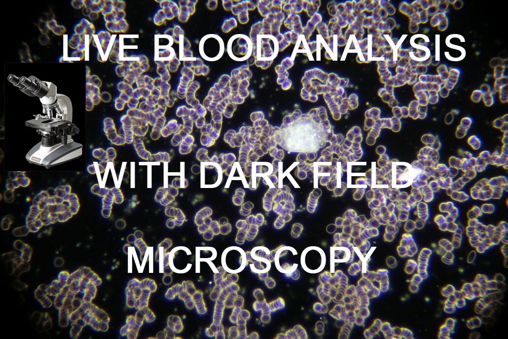 Live Blood Dark Field Microscopy Analysis: Conversation with an Expert ...